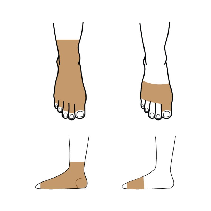 Custom Compression Garments - US Compression Garments Customized Wear ...